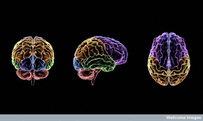 BrainGate — Atlas of the Future